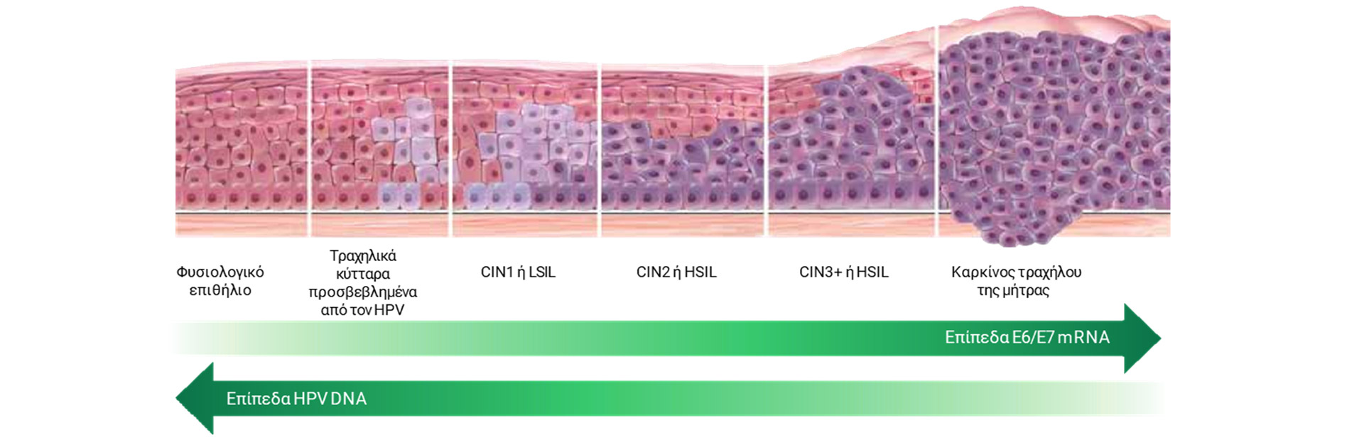 Aptima HPV mRNA test - ISTOLOGIC